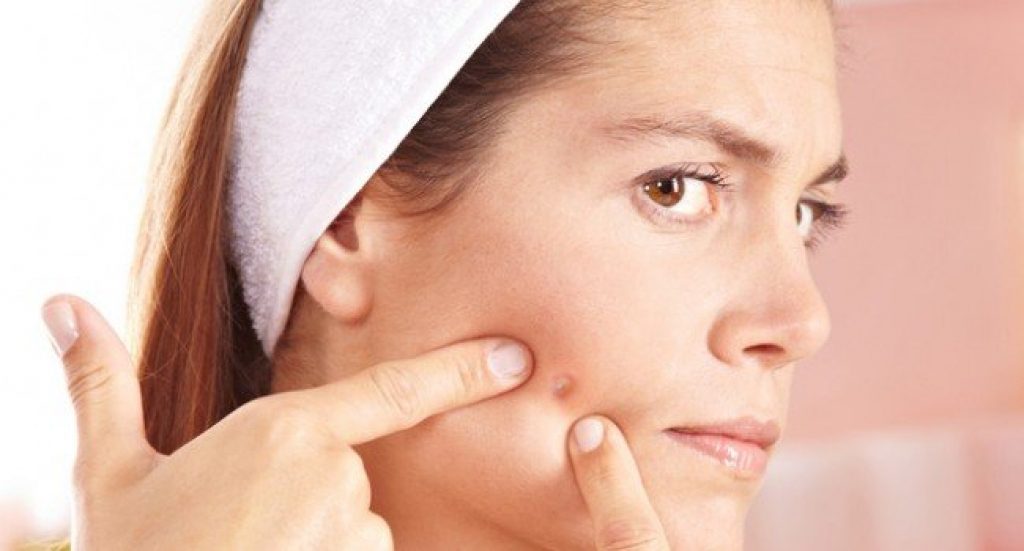 Espinhas internas: saiba como se livrar delas e evitar esse problema ...