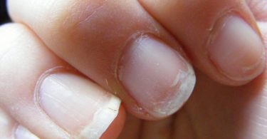 Tranças embutidas: aprenda 5 modelos lindos e fáceis de fazer - Tudo Ela