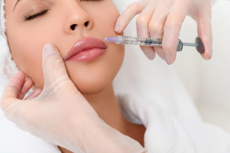 Preenchimento labial: tudo sobre o procedimento - Tudo Ela